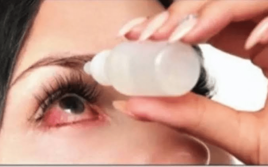 Pink Eye: Surge In Contagious Conjunctivitis Cases Amidst Persistent ...